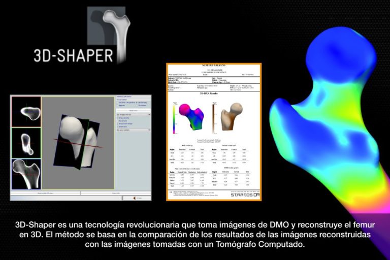 Software - 3D-SHAPER - 0steomedical