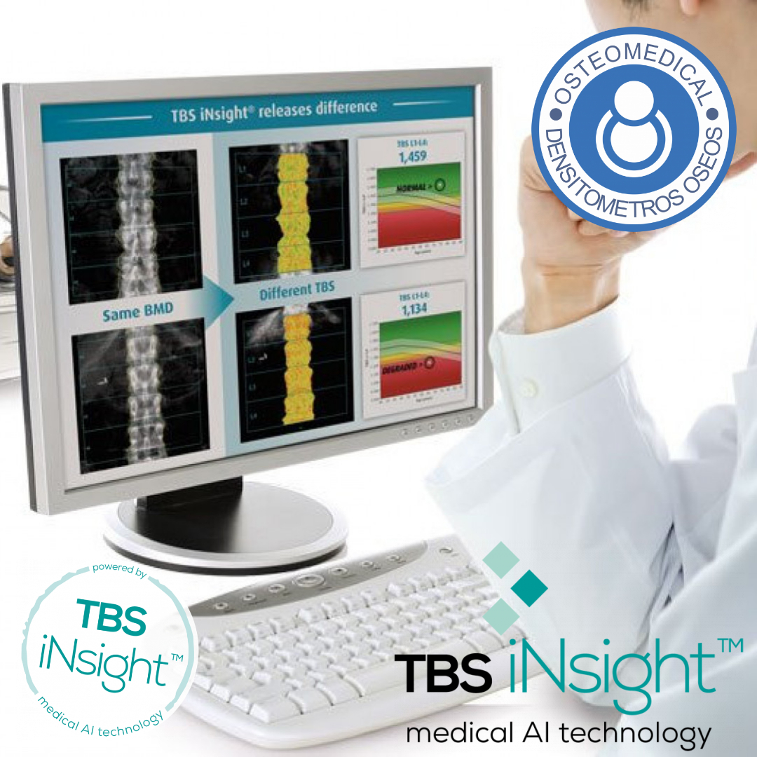 Software TBS - TBS Insight - 0steomedical